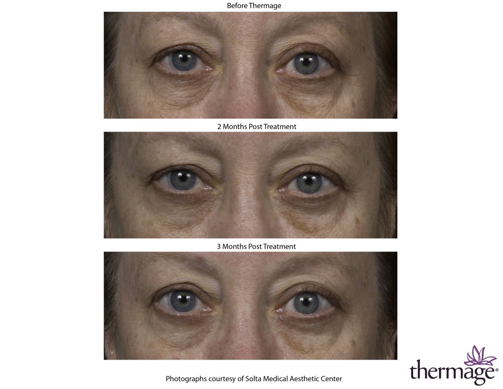 The Best Aesthetic Eye Treatments | Enhanze Clinic
