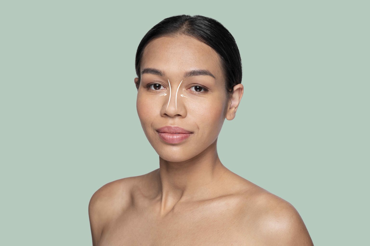 Nose Thread Lift: Pros & Cons Explained
